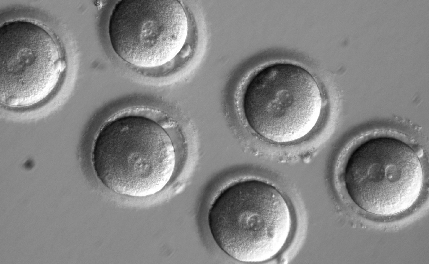 The Week In Review: First Human Embryo Editing Experiment In U.S ...